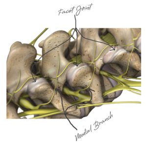 Lower Back Vs. Hip Pain - Best Practice Health